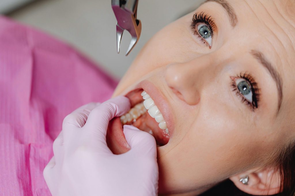 Root Canal vs Extraction: Which Is the Better Option?