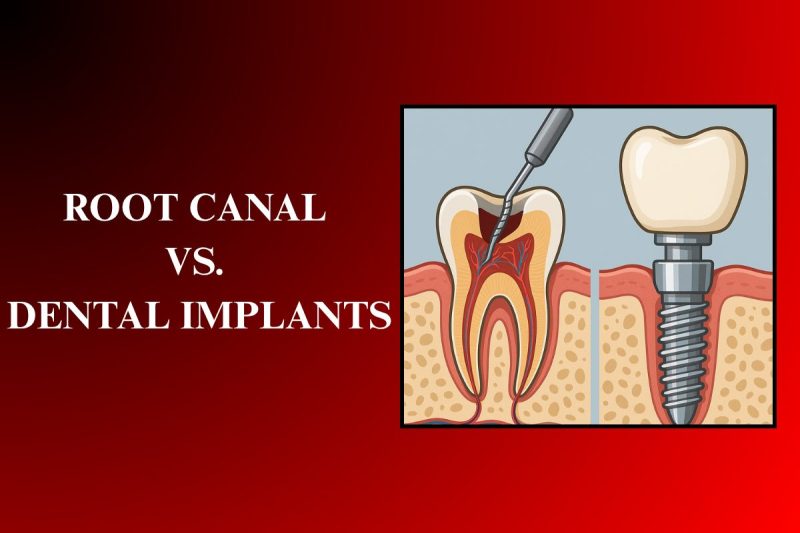 Types of Dental Fillings: Which One is Right for You?